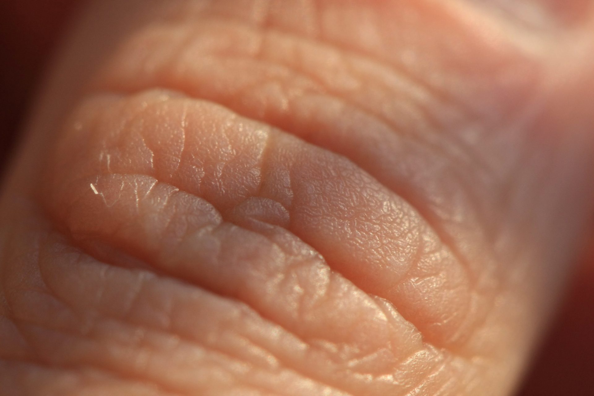 Why do light-skinned people shed more dead skin cells - Life's ...